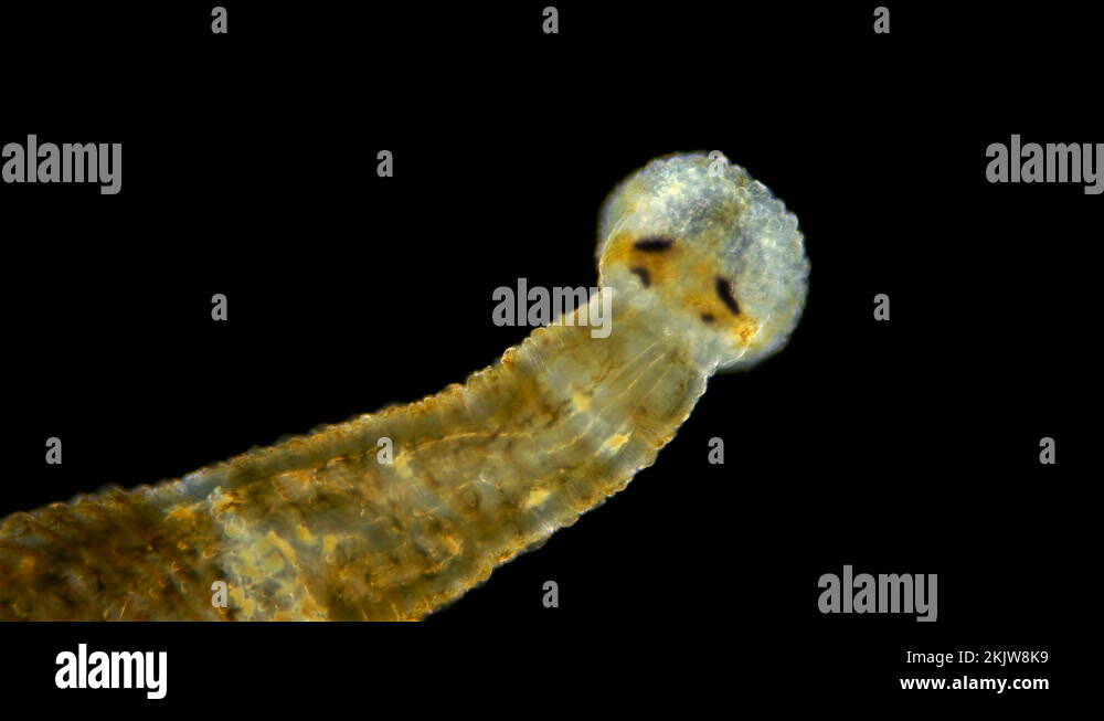 Leech Hirudinea, Baicalobdella torquata under a microscope, family ...