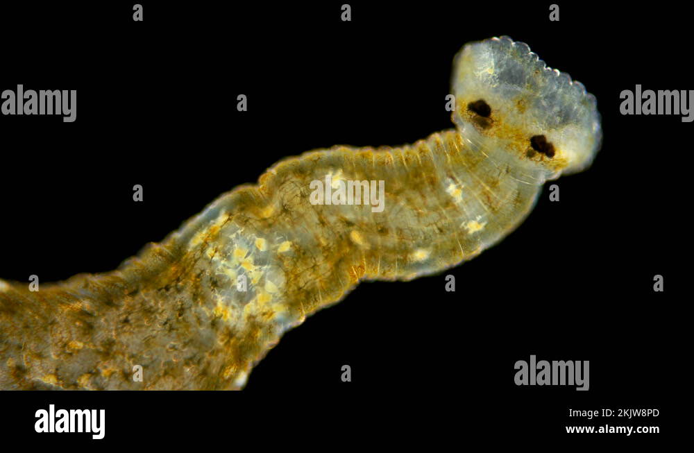 Leech Hirudinea, Baicalobdella torquata under a microscope, family ...