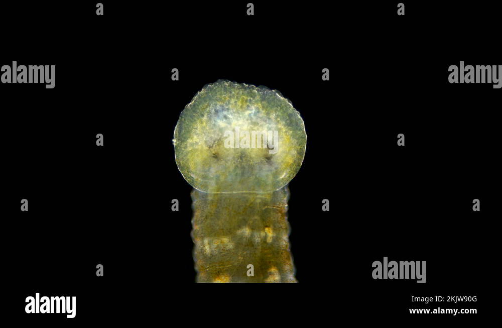 Leech Hirudinea, Baicalobdella torquata under a microscope, family ...