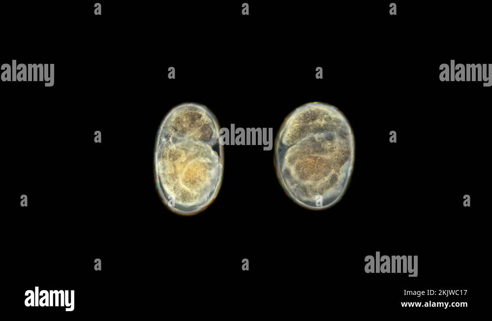 Gammarida Stock Videos & Footage - HD and 4K Video Clips - Alamy