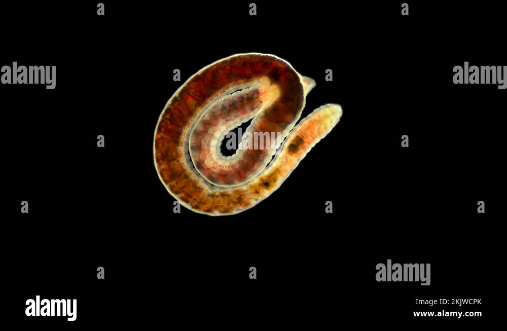 Worm of the Lumbriculidae family under a microscope, class Clitellata ...