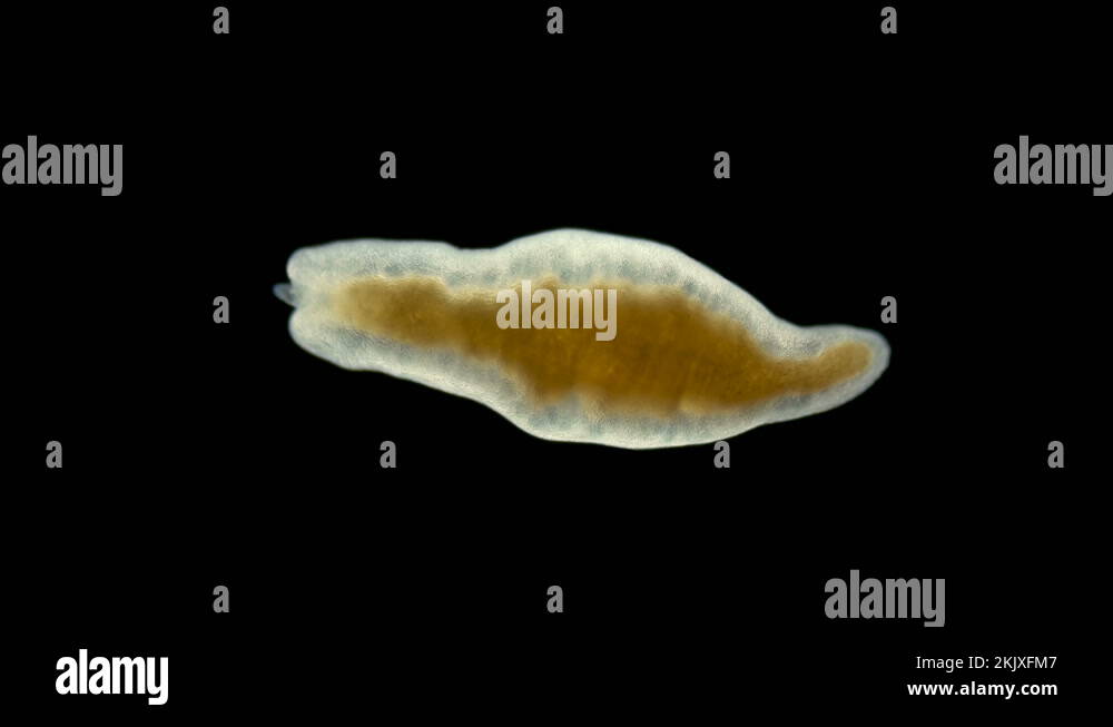 Microturbellaria worm under the microscope, Phylum Platyhelminthes ...