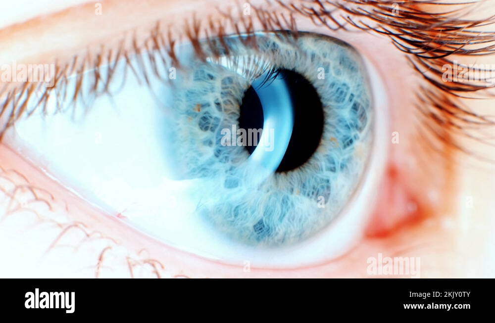 Object in eye medical Stock Videos & Footage - HD and 4K Video Clips ...