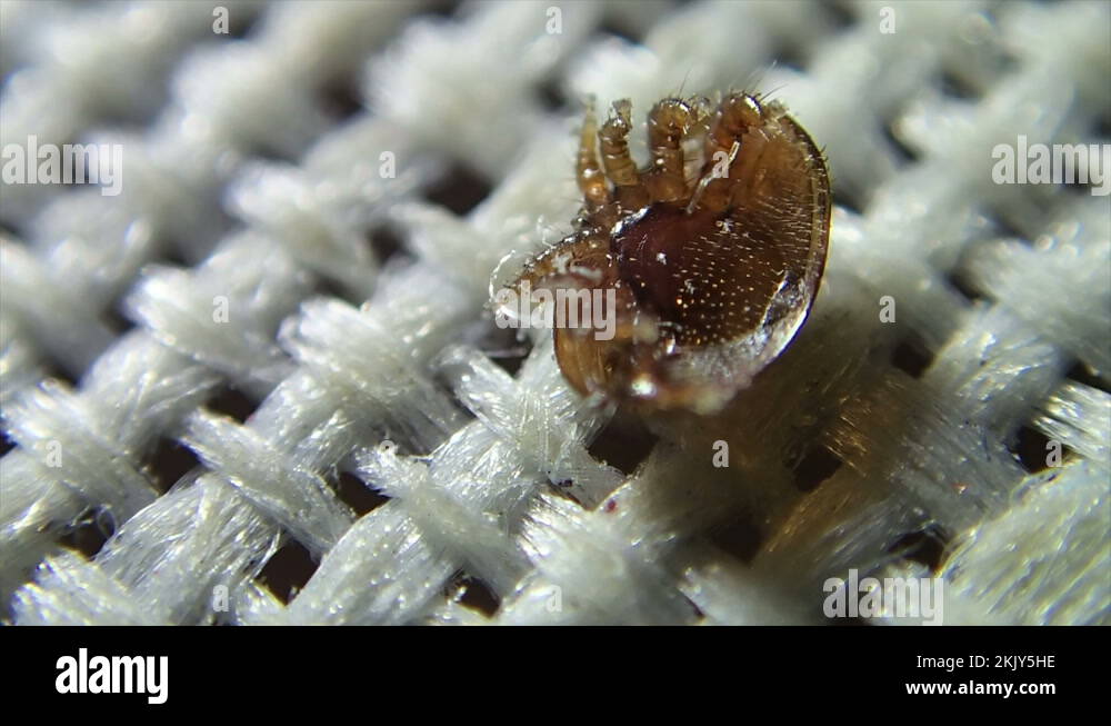 Varroa mite Stock Videos & Footage - HD and 4K Video Clips - Alamy