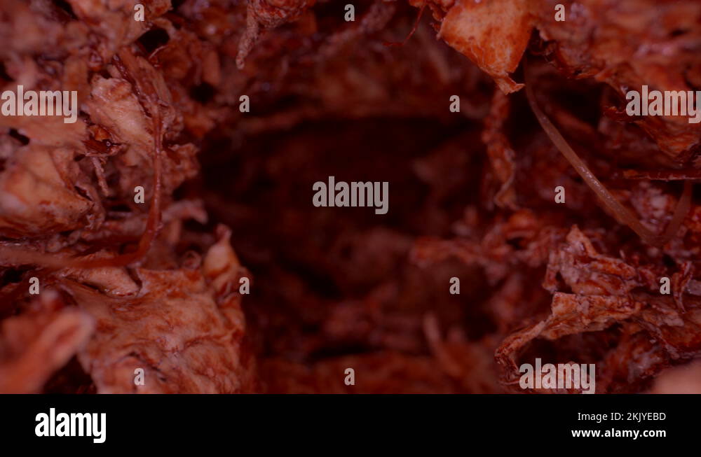 Guts anatomy Stock Videos & Footage - HD and 4K Video Clips - Alamy
