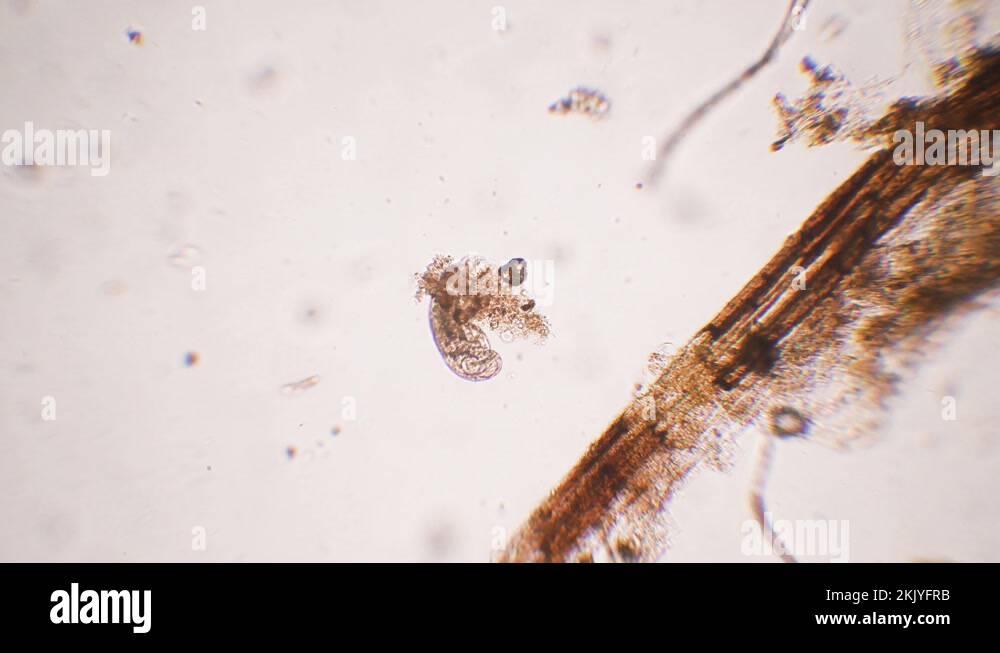 Tardigrades , moss piglets, water bears. Tardigrada, Ticino river ...