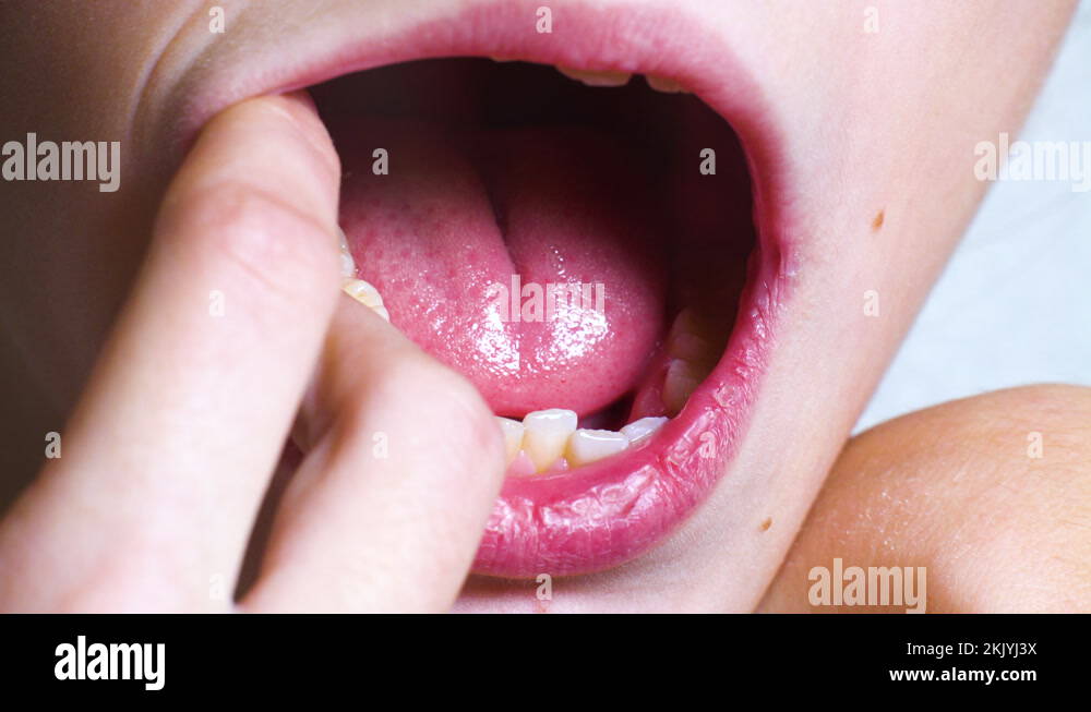 Rows of teeth Stock Videos & Footage - HD and 4K Video Clips - Alamy