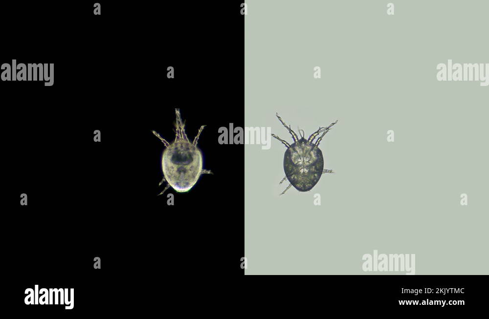 Astigmatina Stock Videos & Footage - HD and 4K Video Clips - Alamy