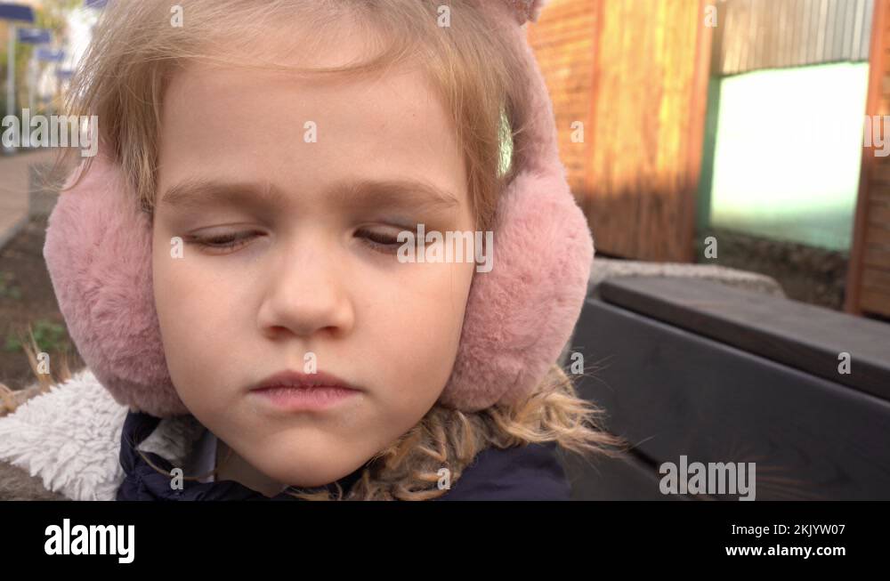 A bruise on the little girl's left eye. bruised eyelid Stock Video ...