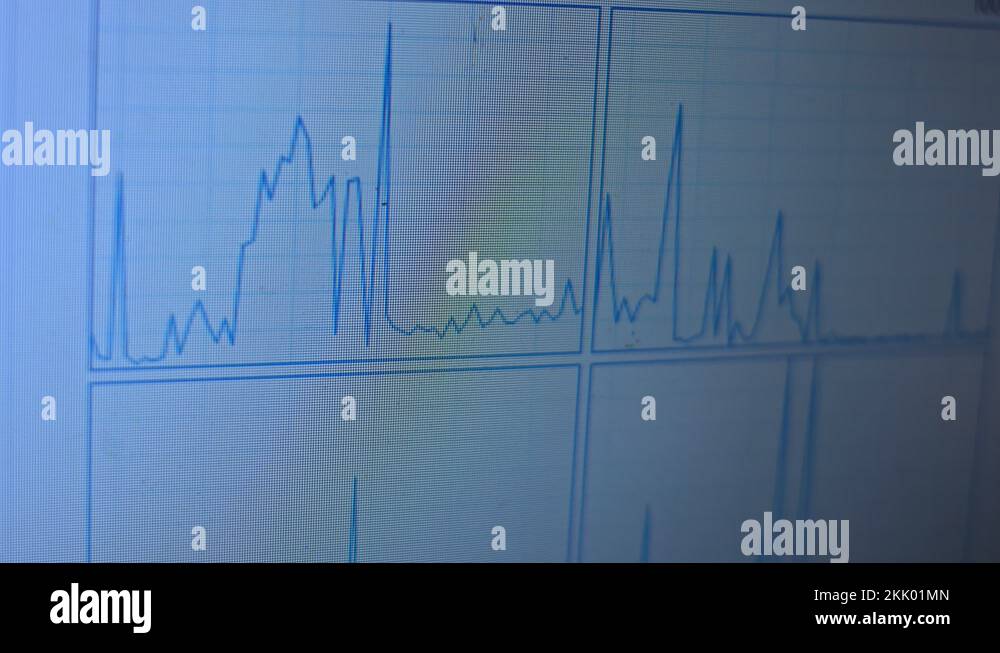Close-up of server's working process. Indicator of CPU working power ...