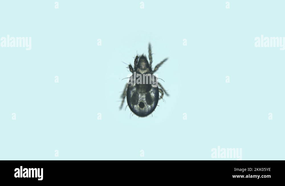 Acari (mite) Oribatida under microscope are saprosphago, , order ...