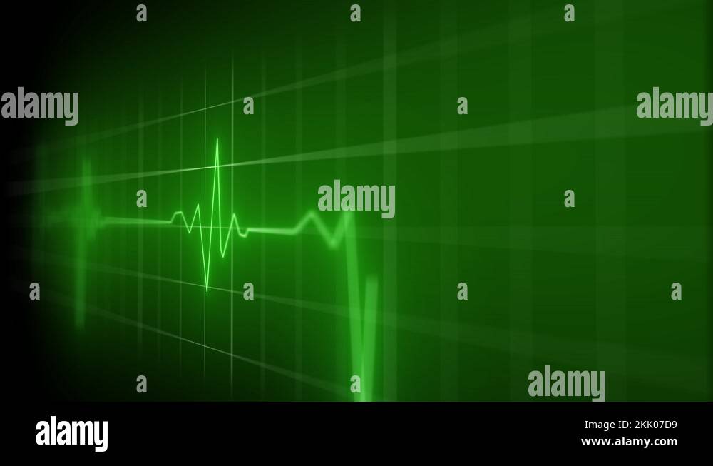 Slowmotion concept animation of an ECG , EKG heartbeat cardiogram on a ...