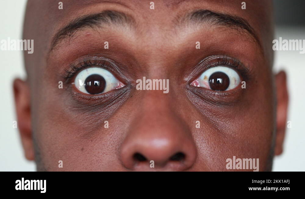 African man SHOCK reaction, Close-up black guy eyes with SURPRISE Stock ...