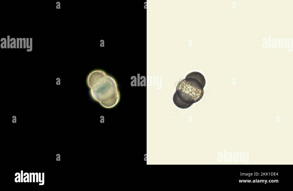 pollen or microspores of Pinóphyta (Coníferae) trees under a microscope ...