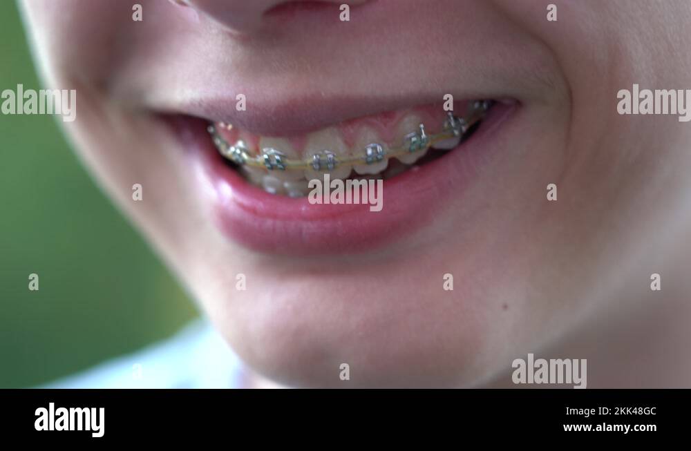 Girl 13 years old smiling Stock Videos & Footage - HD and 4K Video ...