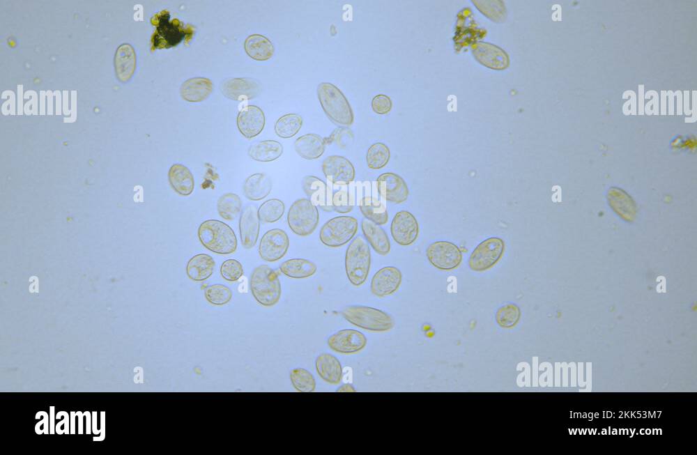 Paramecium single cell organisms in microscope bright field Stock Video ...