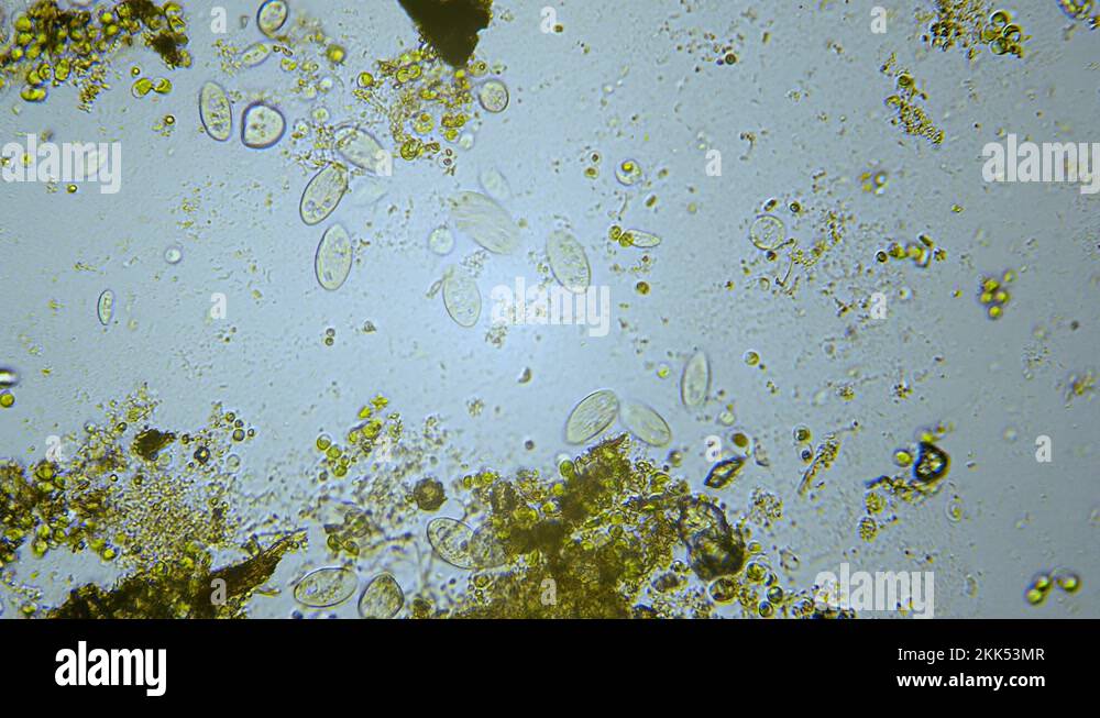 Paramecium single cell organisms in microscope bright field Stock Video ...