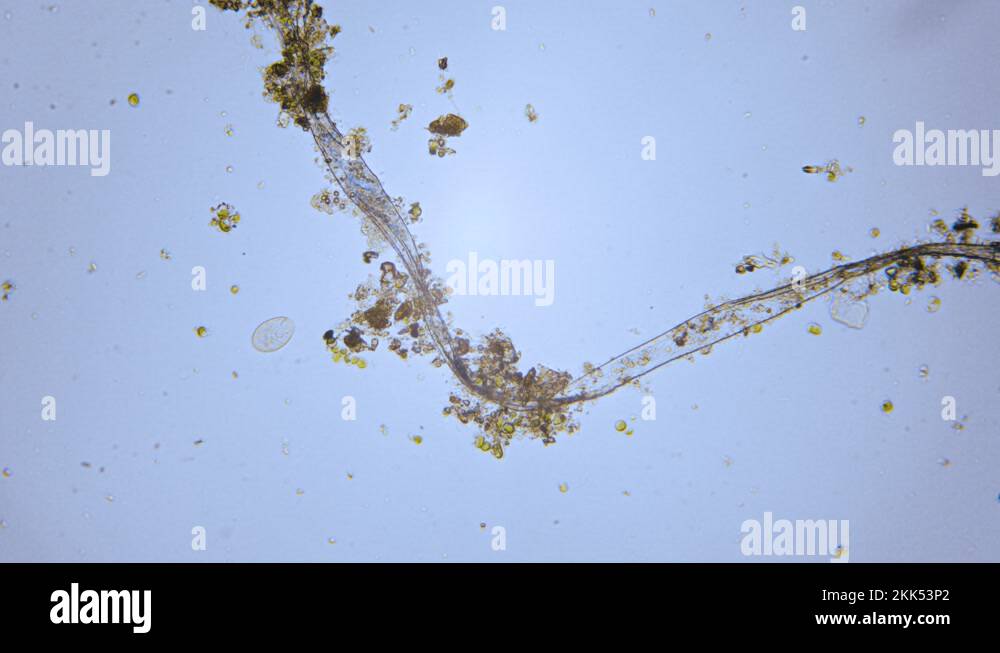 Paramecium single cell organisms in microscope bright field Stock Video ...