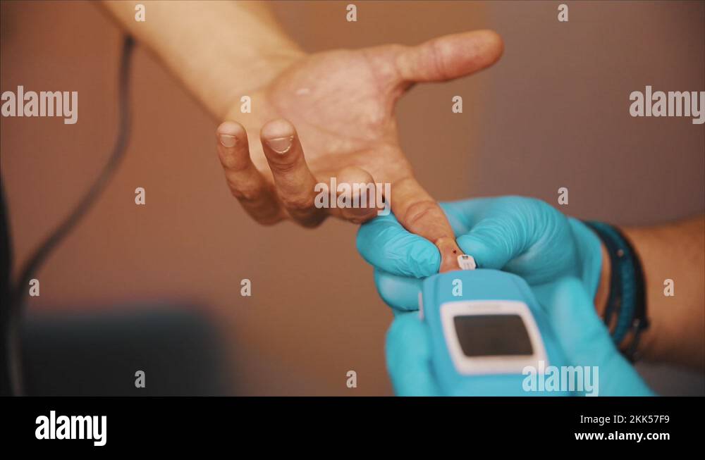 Doctor measures blood glucose level with a glucometer. Express ...