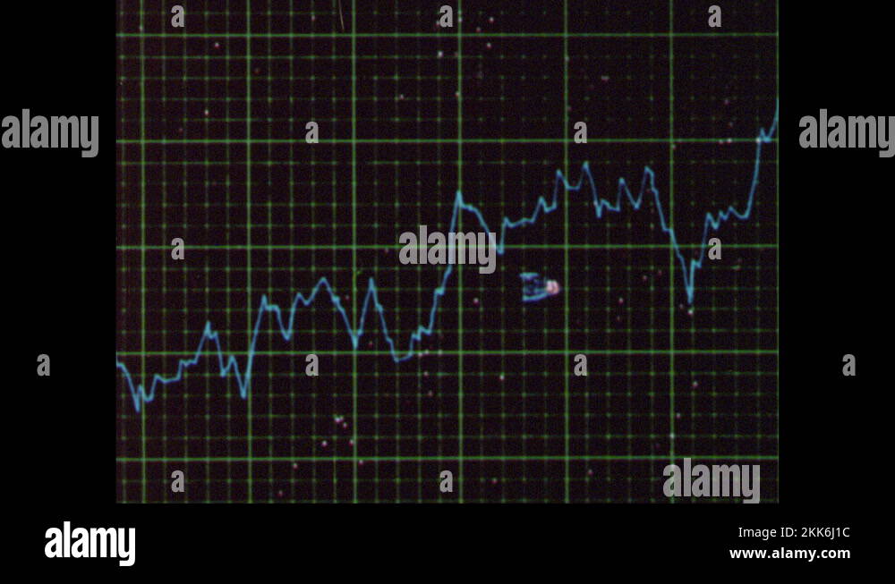 1960s Organism Floating In Space Waves On Graph Anatomy Of Human