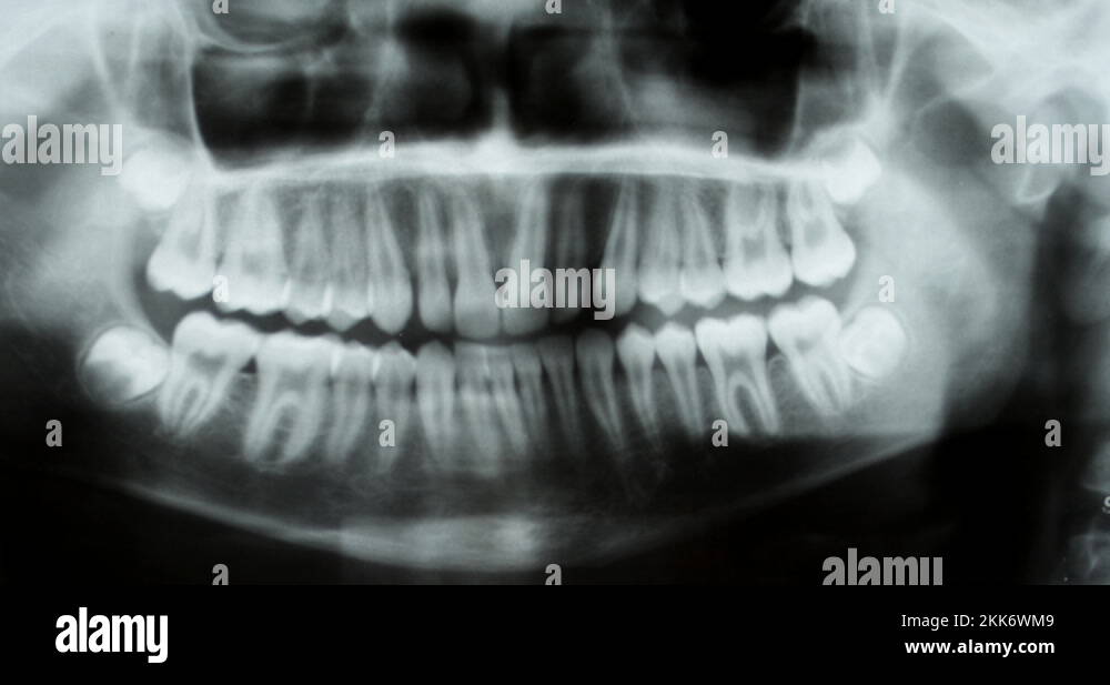X ray human face Stock Videos & Footage - HD and 4K Video Clips - Alamy