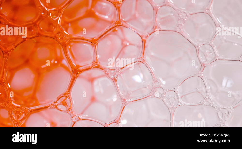 Blood seeping through bubbles. failing lungs. high altitude pulmonary ...