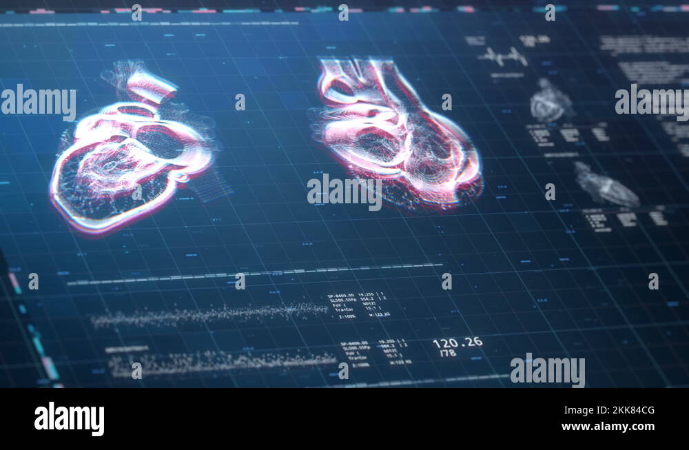 Cardiac mri Stock Videos & Footage - HD and 4K Video Clips - Alamy