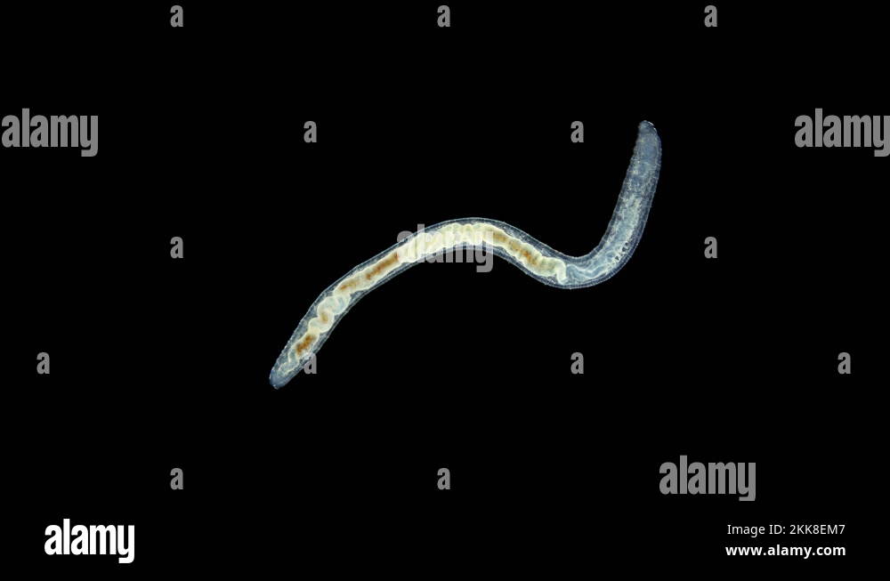 the worm Enchytraeus sp. under the microscope, Oligochaeta, order ...