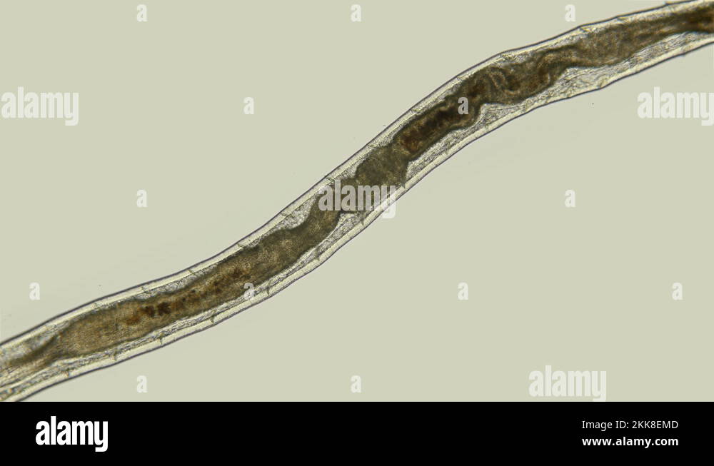 the worm Enchytraeus sp. under the microscope, Oligochaeta, order ...