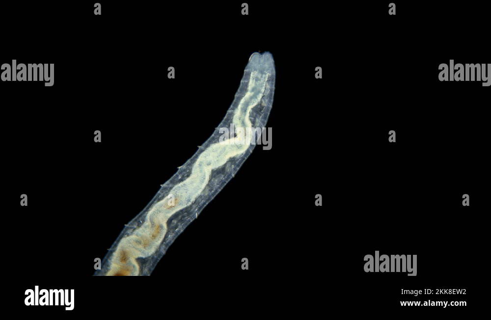 the worm Enchytraeus sp. under the microscope, Oligochaeta, order ...