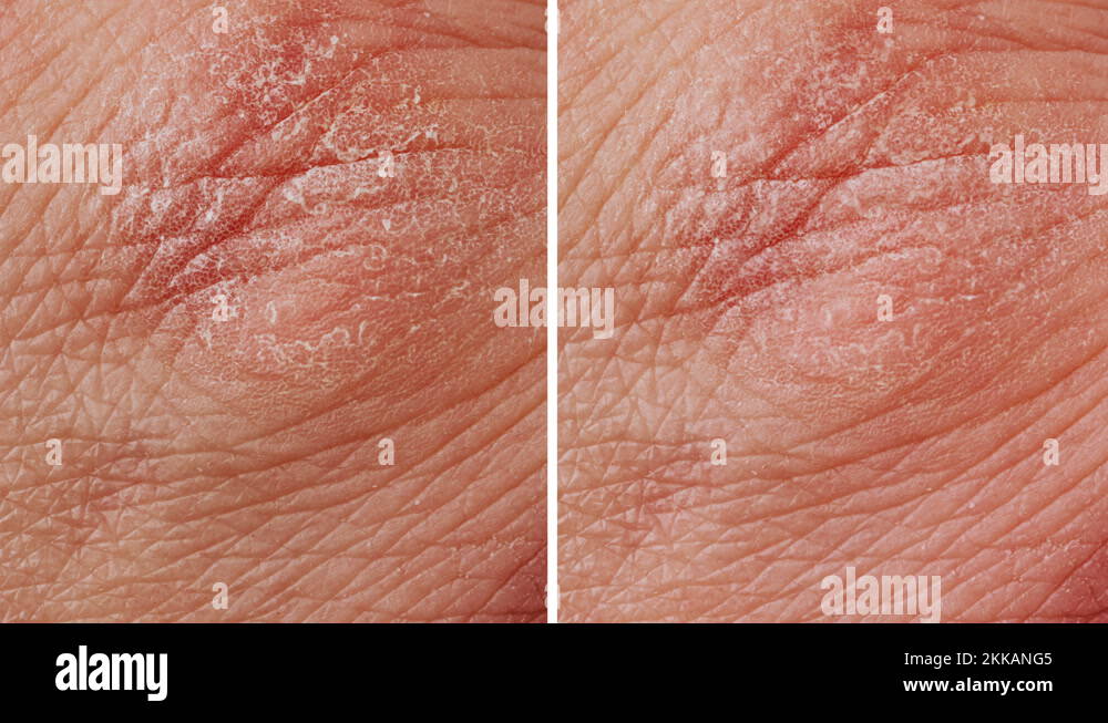 Skin creases Stock Videos & Footage - HD and 4K Video Clips - Alamy