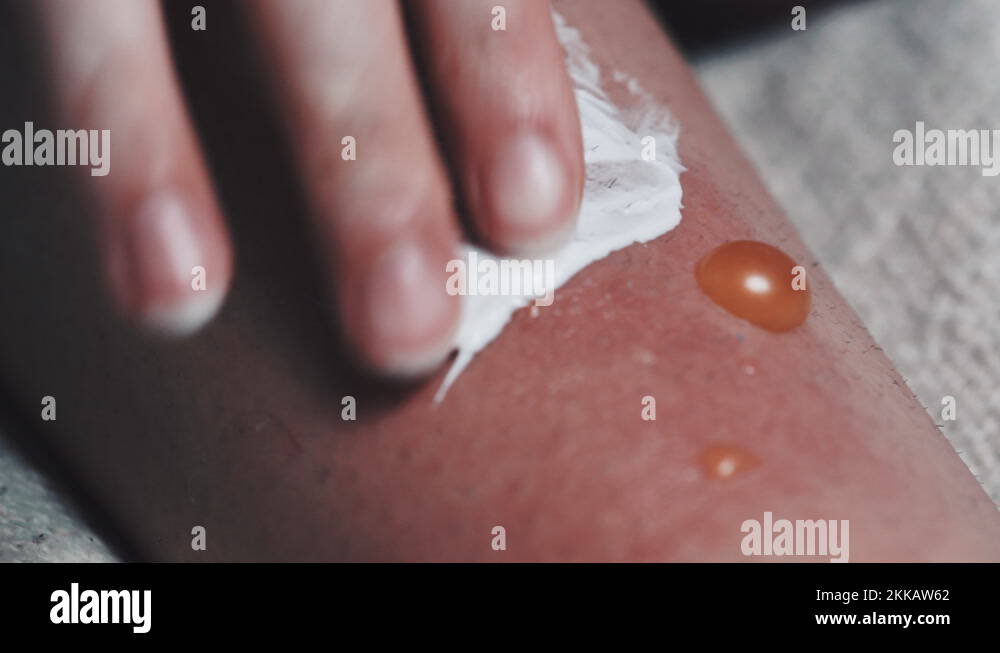 Fluid discharge Stock Videos & Footage - HD and 4K Video Clips - Alamy