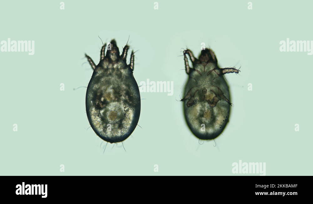 Acari (mite) of the order Sarcoptiformes under the microscope, family ...