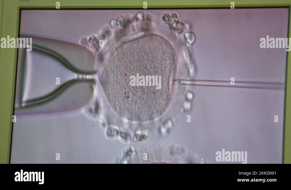 Female egg Stock Videos & Footage - HD and 4K Video Clips - Alamy