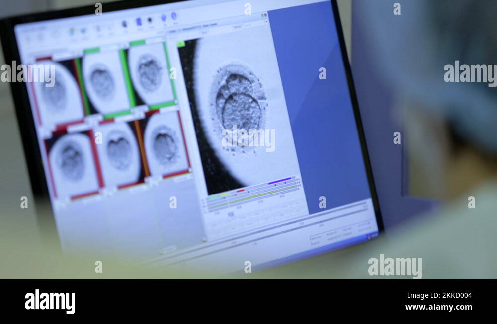 Medical Laboratory. Snapshots Germ of Man. Fertilization. Doctors ...