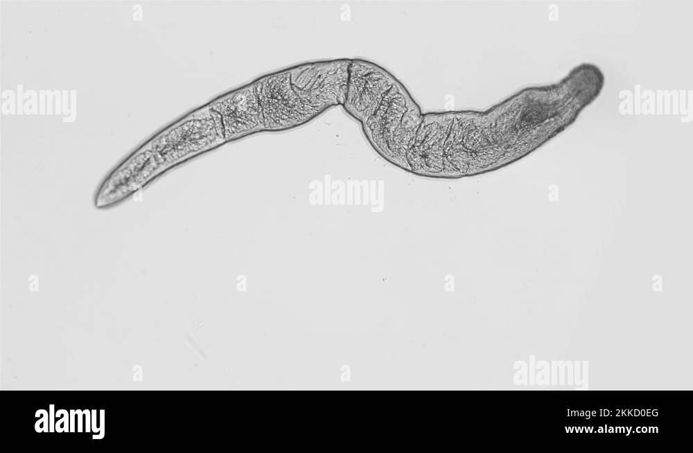 Nemertea worm under a microscope, supertype Spiralia Stock Video Footage - Alamy
