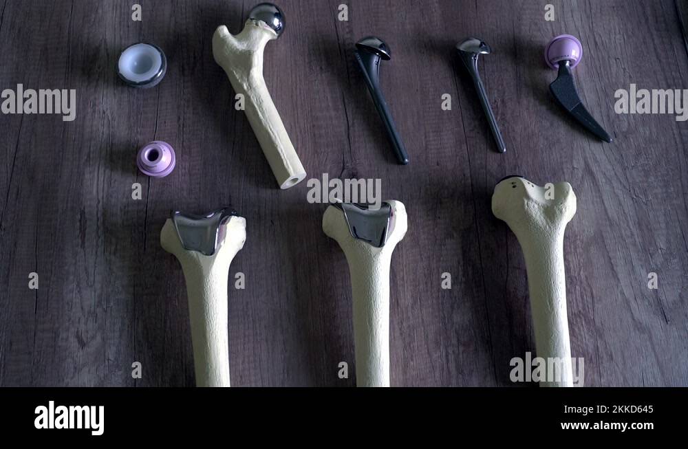 Human knee joints Stock Videos & Footage - HD and 4K Video Clips - Alamy