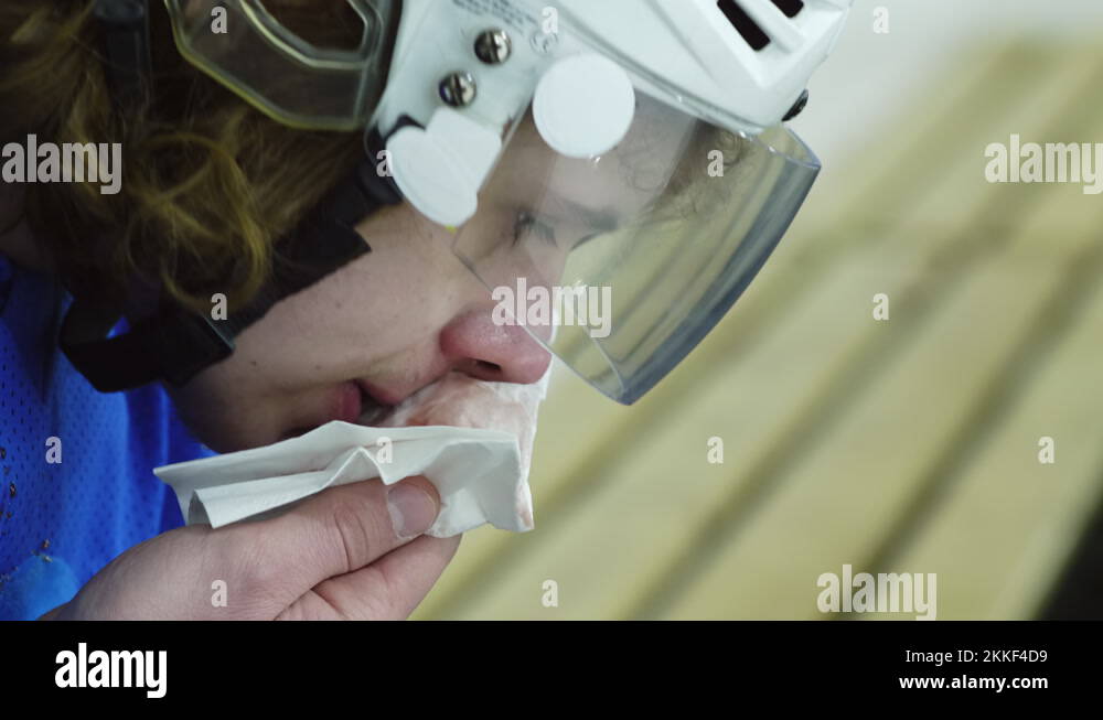 Broken nose man blood Stock Videos & Footage - HD and 4K Video Clips ...