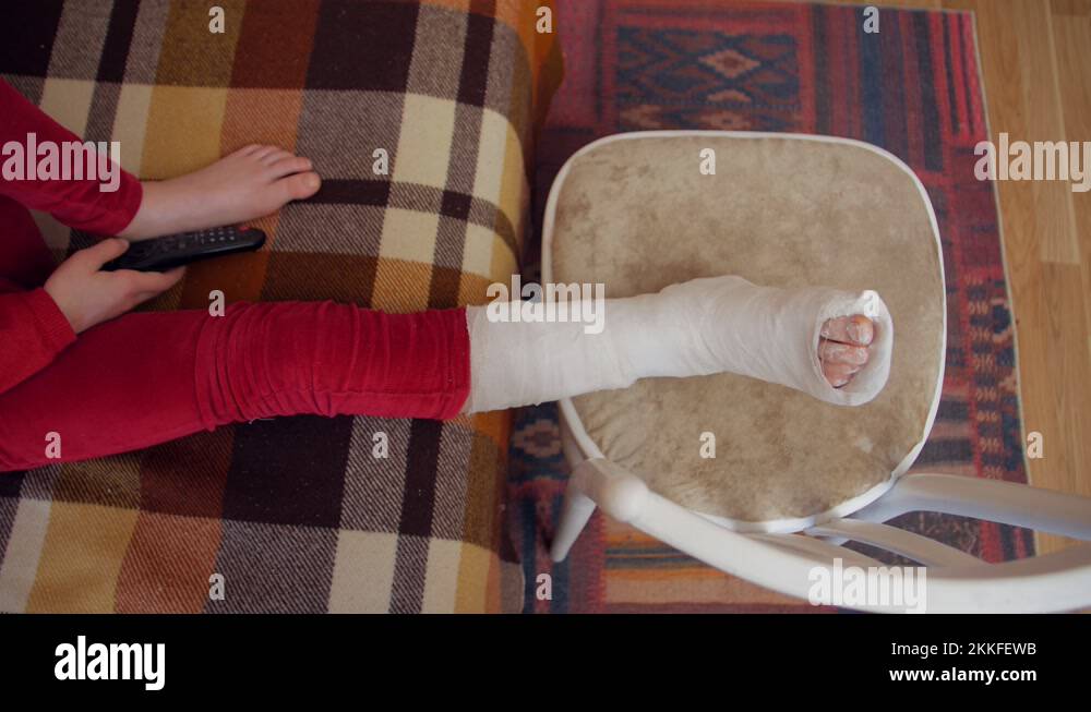 Leg in a cast Stock Videos & Footage - HD and 4K Video Clips - Alamy