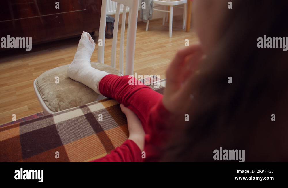 Plaster cast plaster Stock Videos & Footage - HD and 4K Video Clips - Alamy