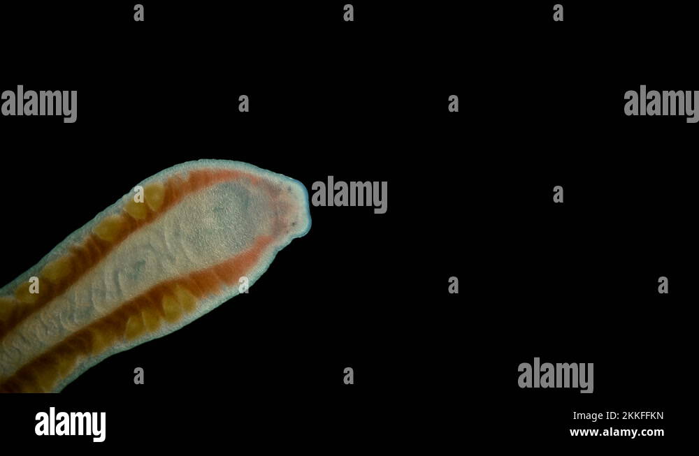 Worm Nemertea Prostoma sp. under the microscope, of the ...