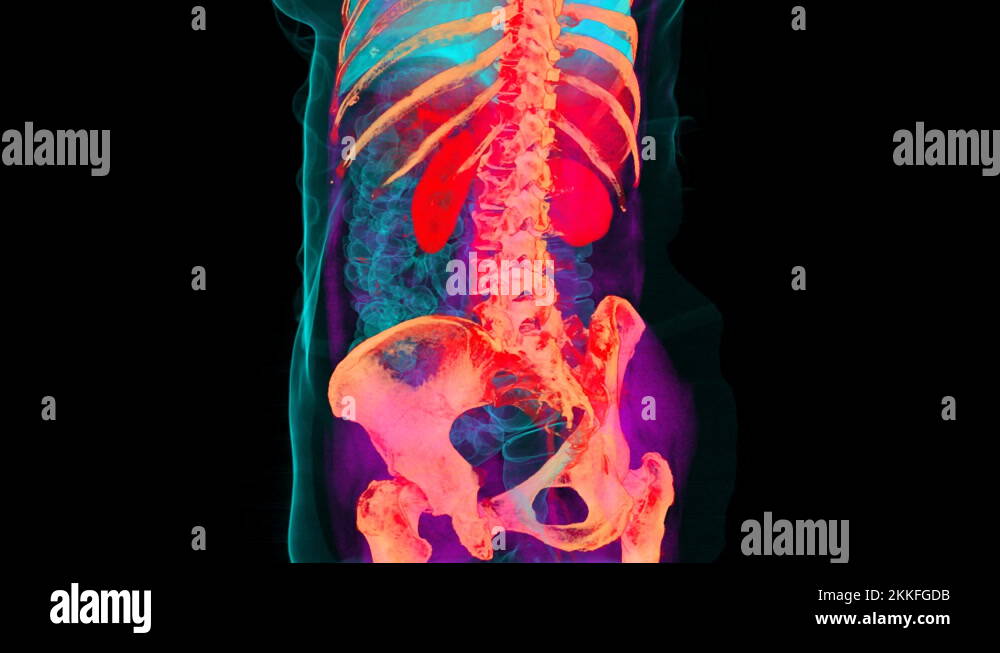 Colon anatomy Stock Videos & Footage - HD and 4K Video Clips - Alamy