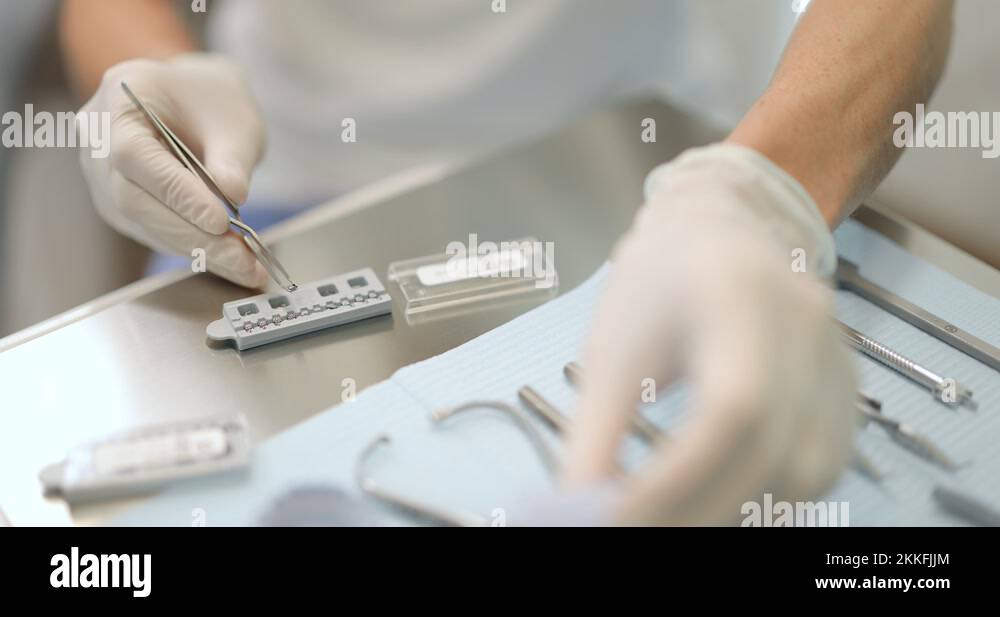 Orthodontist working with jaw model applying brace system Stock Video ...