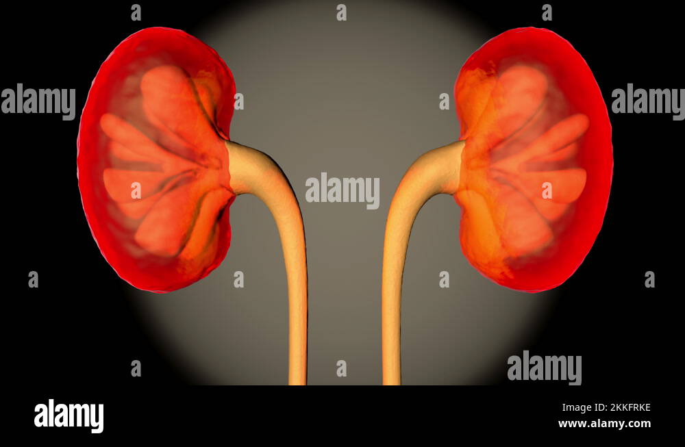 Kidneys dialysis Stock Videos & Footage - HD and 4K Video Clips - Alamy