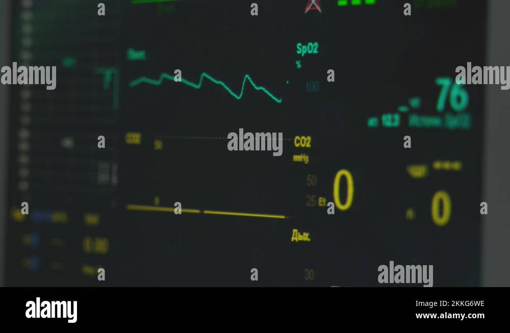 The monitor displays an ECG of the patient's vital signs, oxygen ...