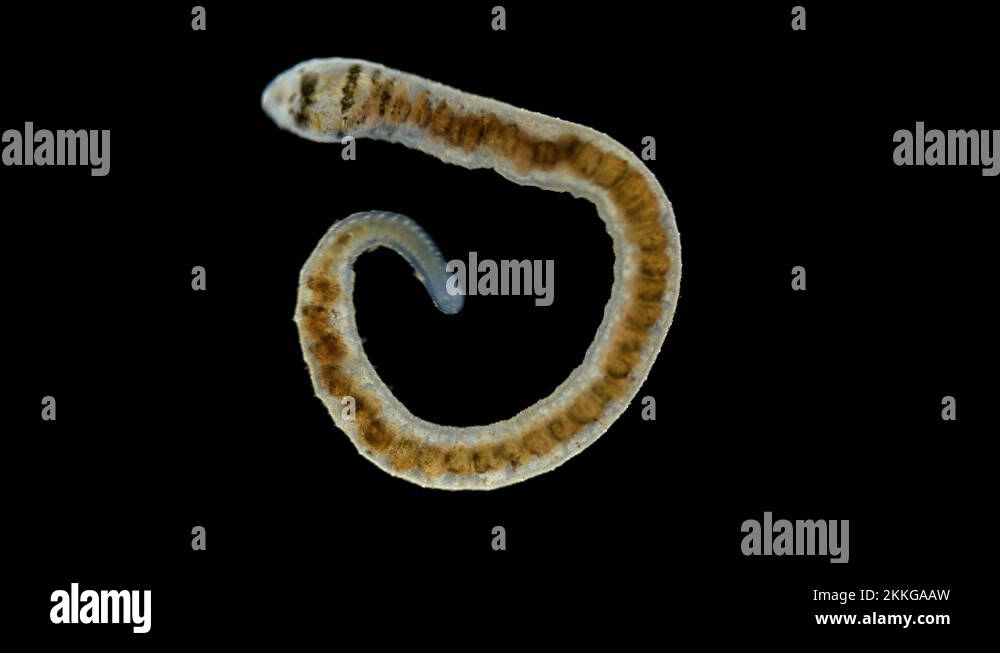 Ophidonais serpentina worm under a microscope, Oligochaeta Subclass ...