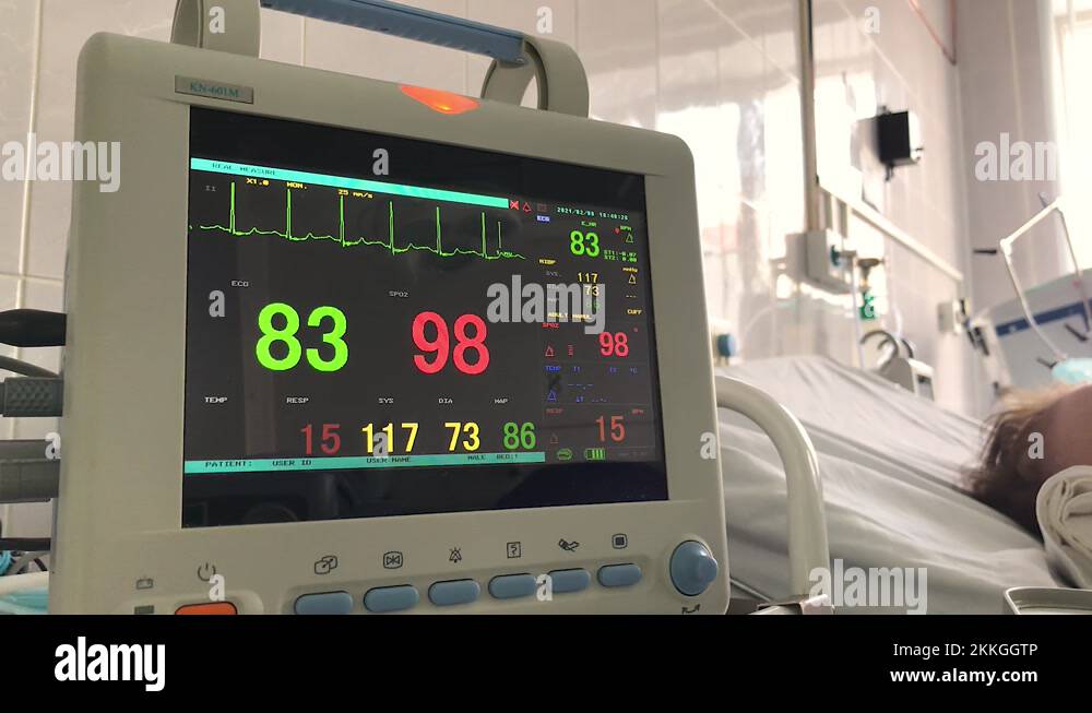 Cardiovascular Medical ICU Monitor with Patient's Vital Signs in ...