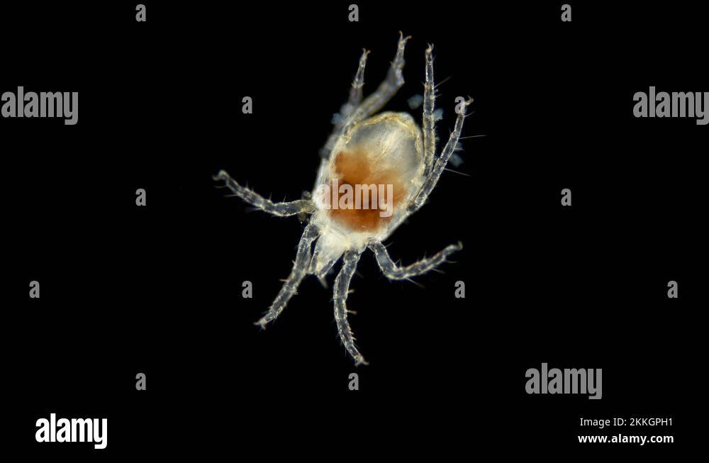 Acari(mite) living in water under a microscope, the superfamily ...