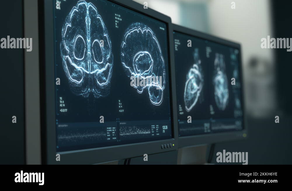 Heart and brain scanning data displayed on hospital monitors Stock ...