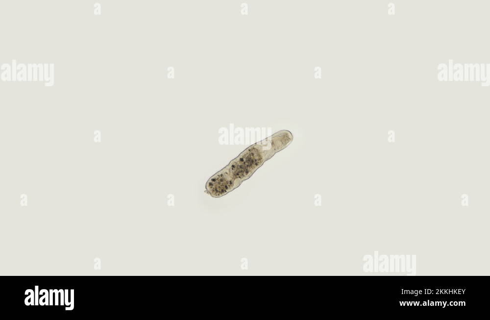 Young worm Microstomum lineare under a microscope, Microstomidae Family ...